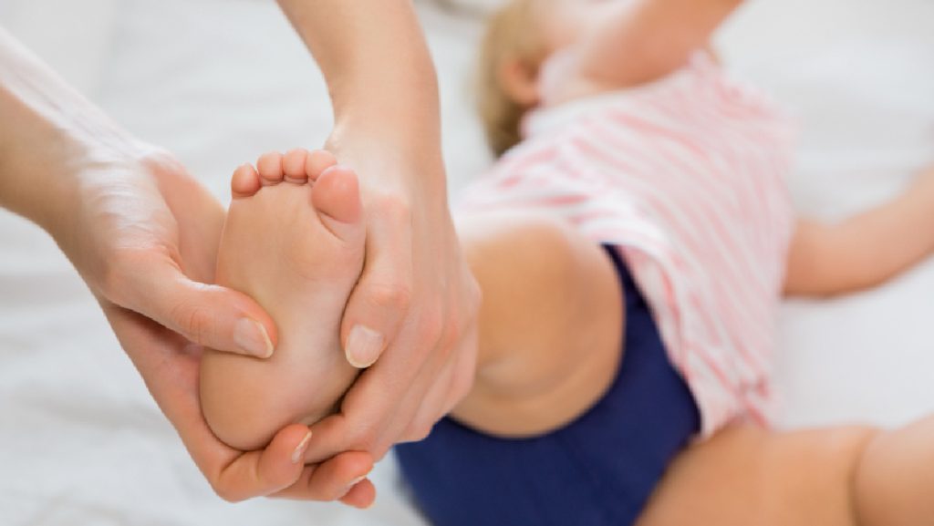 Clubfoot in Newborns - Causes, Symptoms, and Treatment